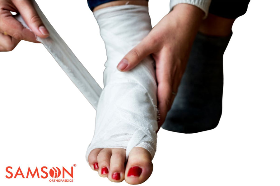 What Is a Cast Shoe and Why It’s Essential for Foot Injury Recovery ...